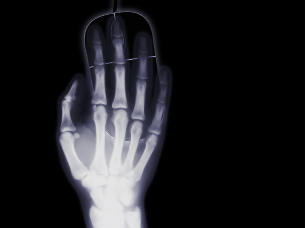 Descubrimiento de los Rayos X | RAISA